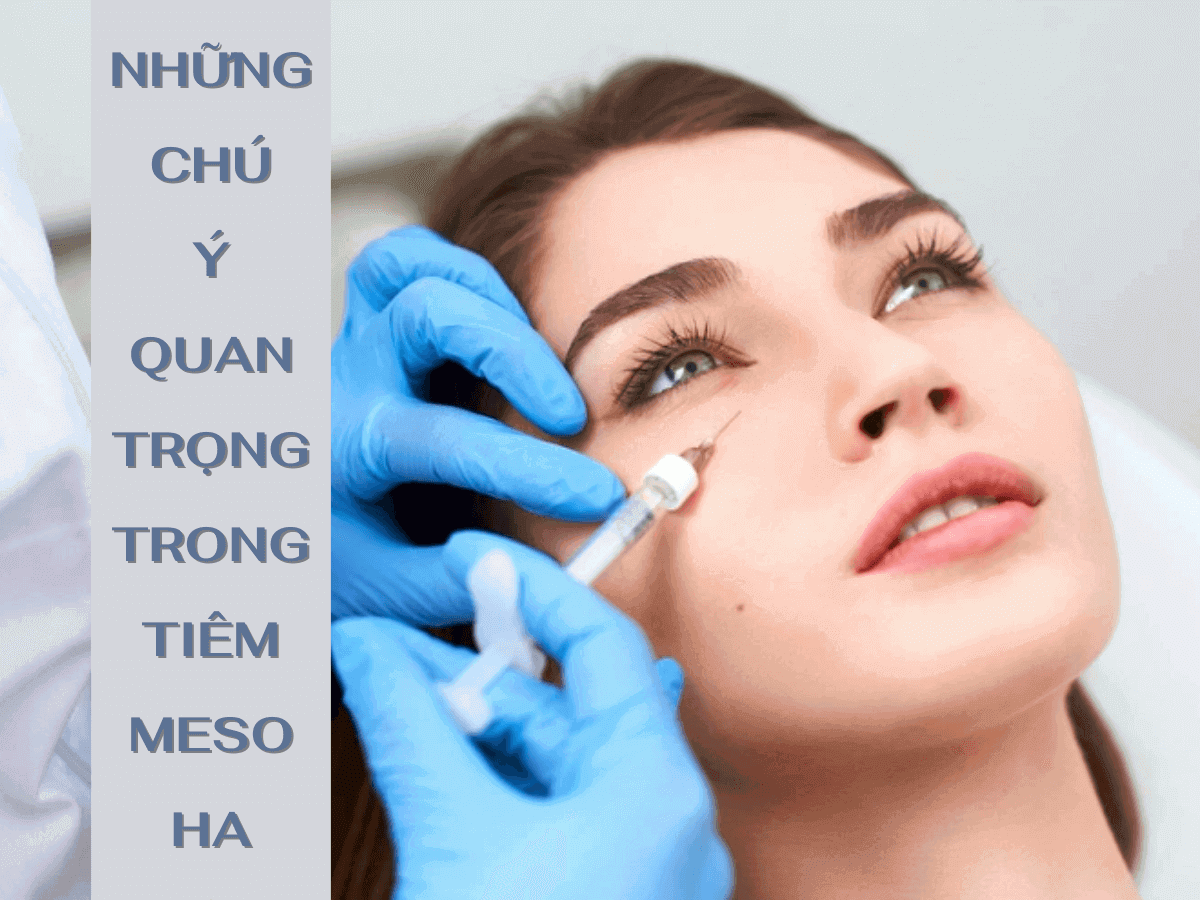 Tiêm Meso HA Là Gì? 8 Điều Nàng Nên Biết Về Tiêm HA Meso