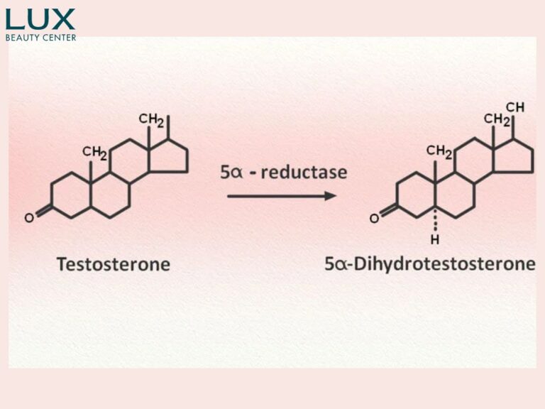 Hormone DHT là gì? Giải mã bí ẩn rụng tóc liên quan đến DHT